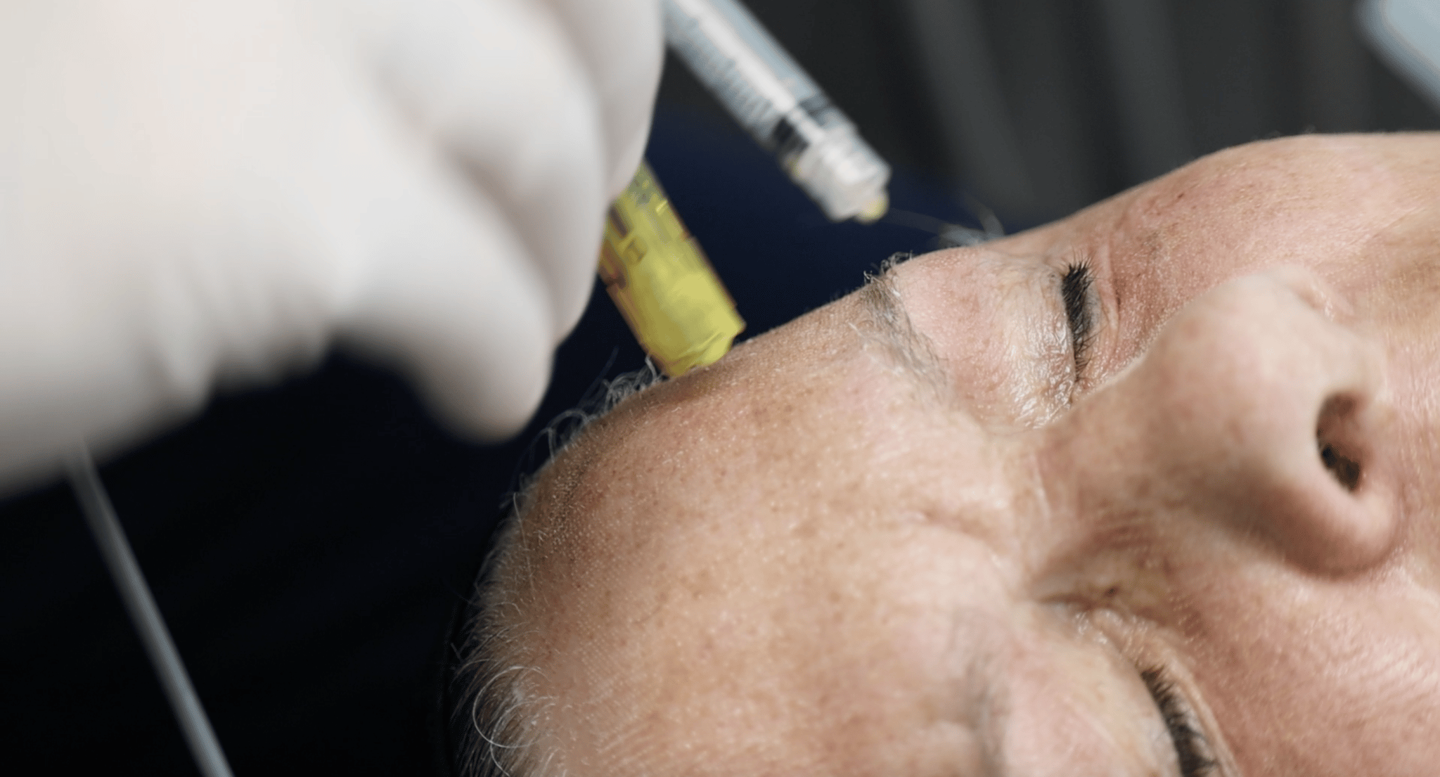 PRF in Clifton, Union & Bridgewater, NJ | Access Dental